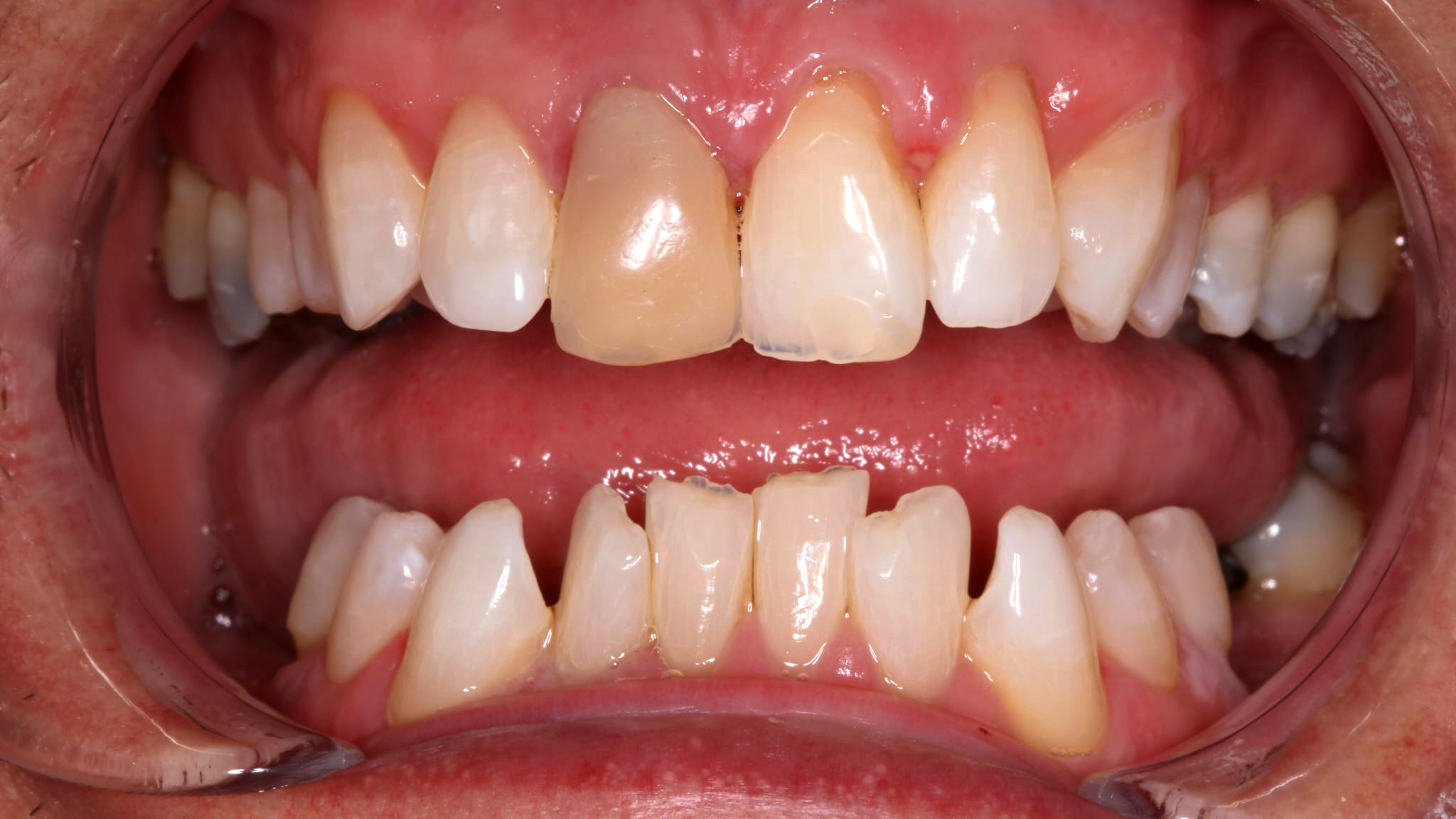 Smile Gallery - Dentist Wolverhampton